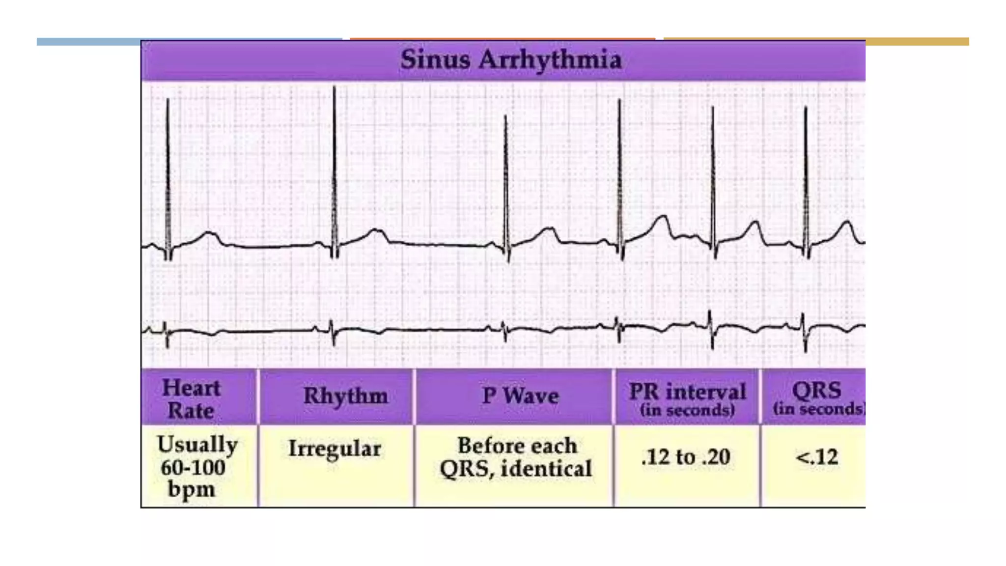 Diskusi Topik - EKG.pptx