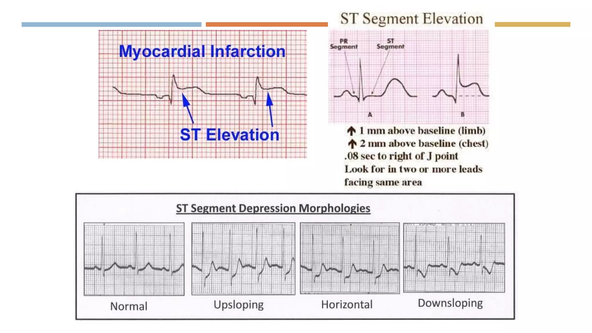 Diskusi Topik - EKG.pptx