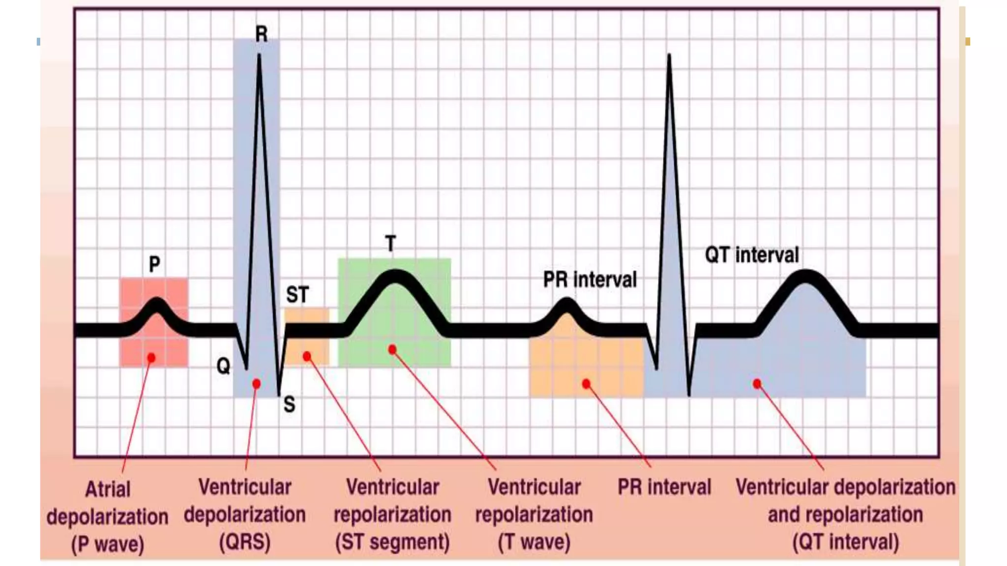Diskusi Topik - EKG.pptx