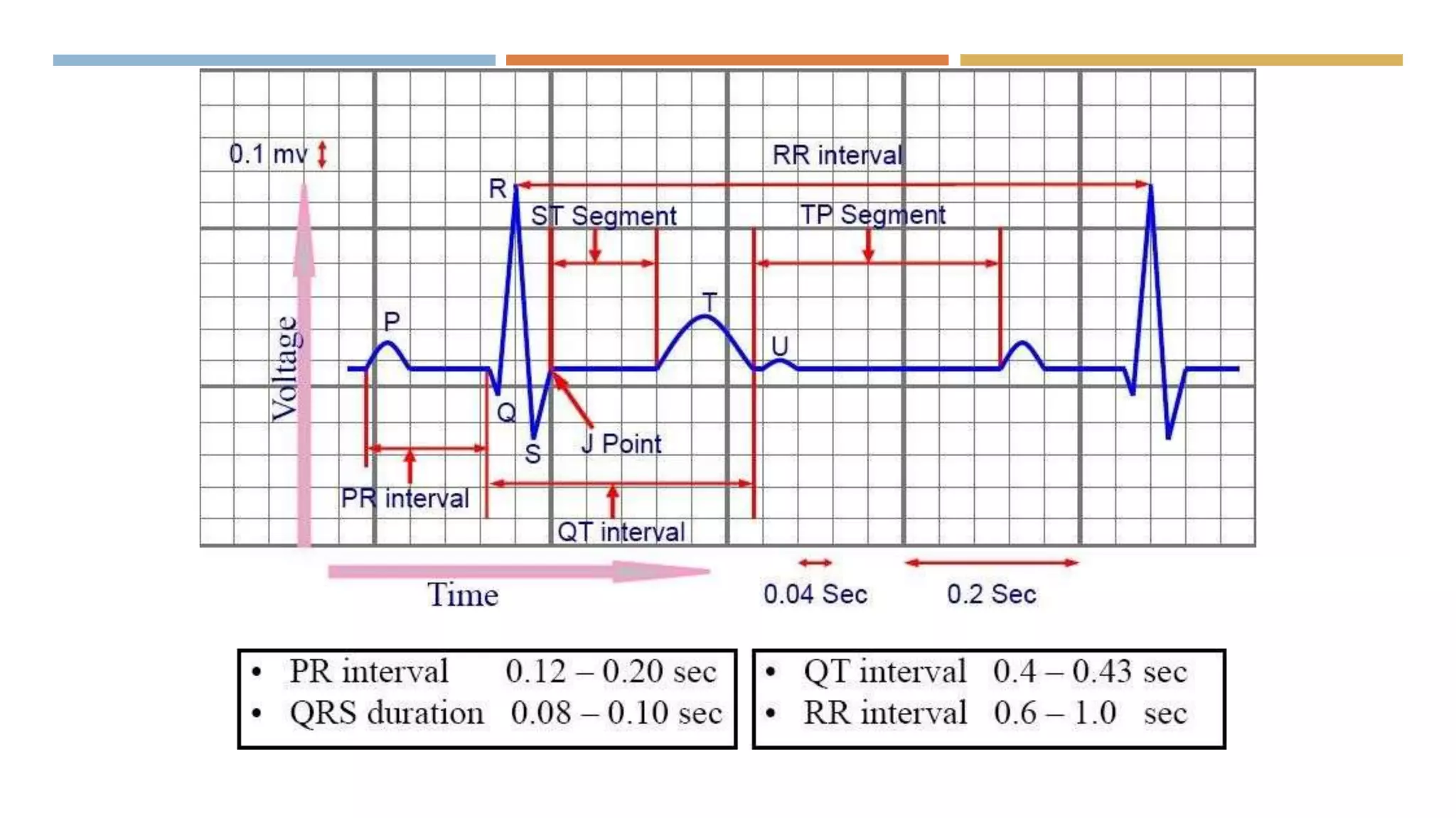 Diskusi Topik - EKG.pptx