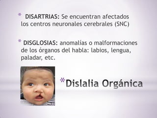 Dislalia | PPTX