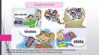 Dislalia | PPTX