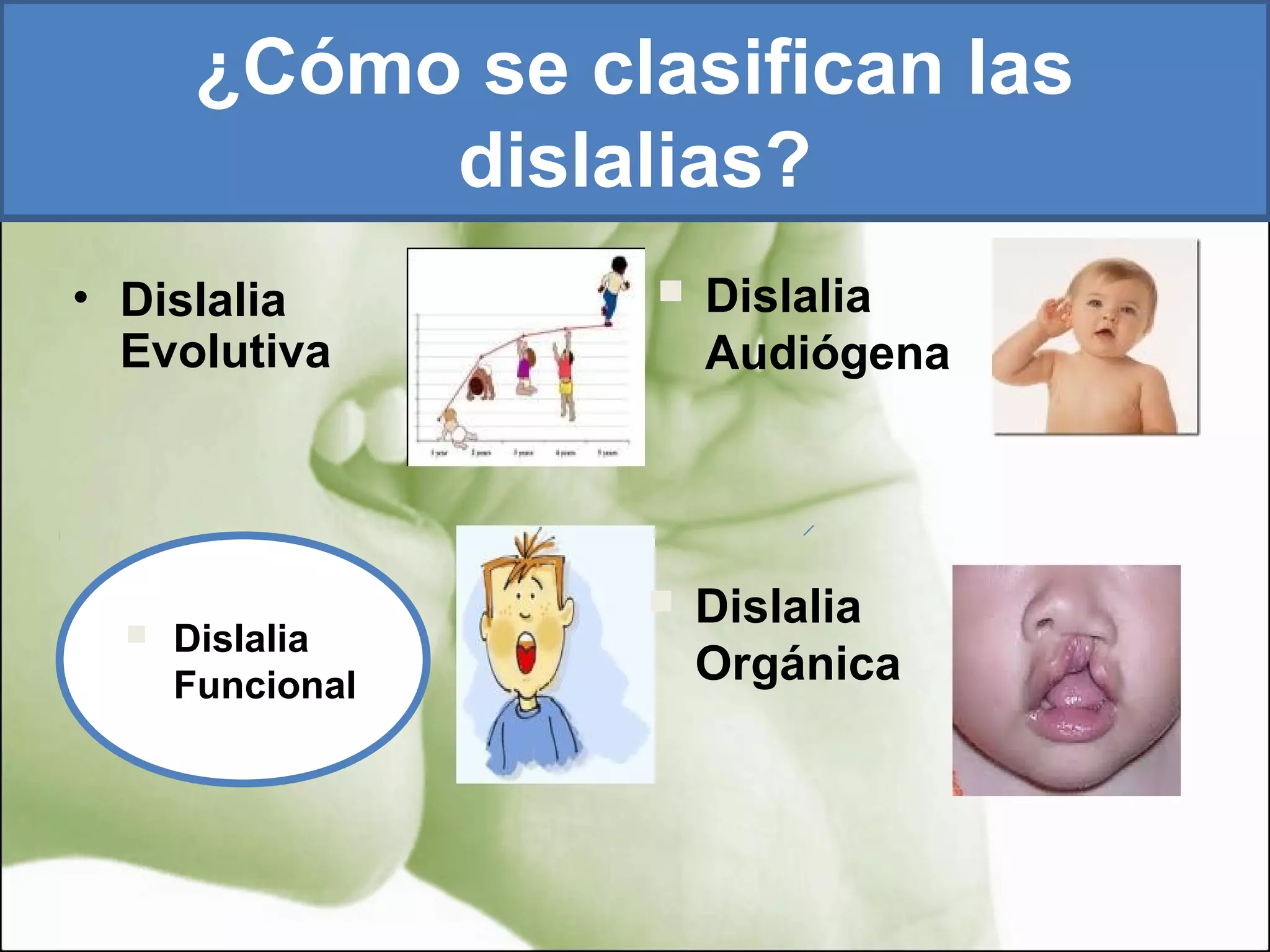Dislalia funcional | PPT