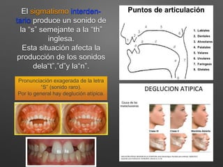 Dislalia, Fonoaudiología, Ortodoncia, Psicología | PPTX