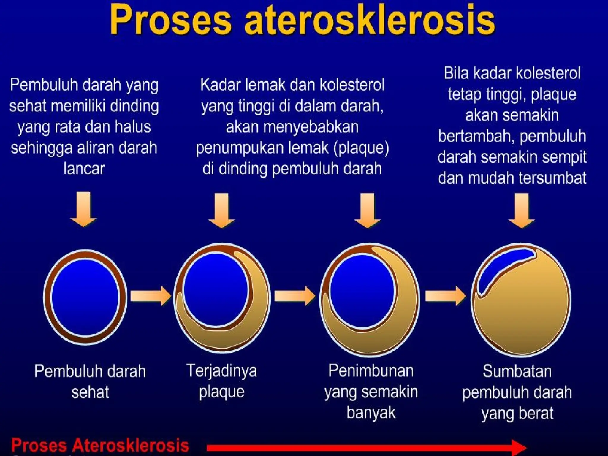 dislipidemia-150820233300-lva1-app6892.ppt