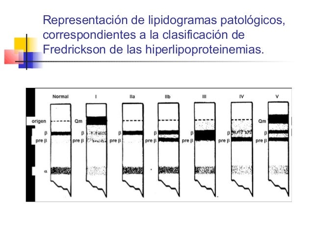 Dislipoproteinemias