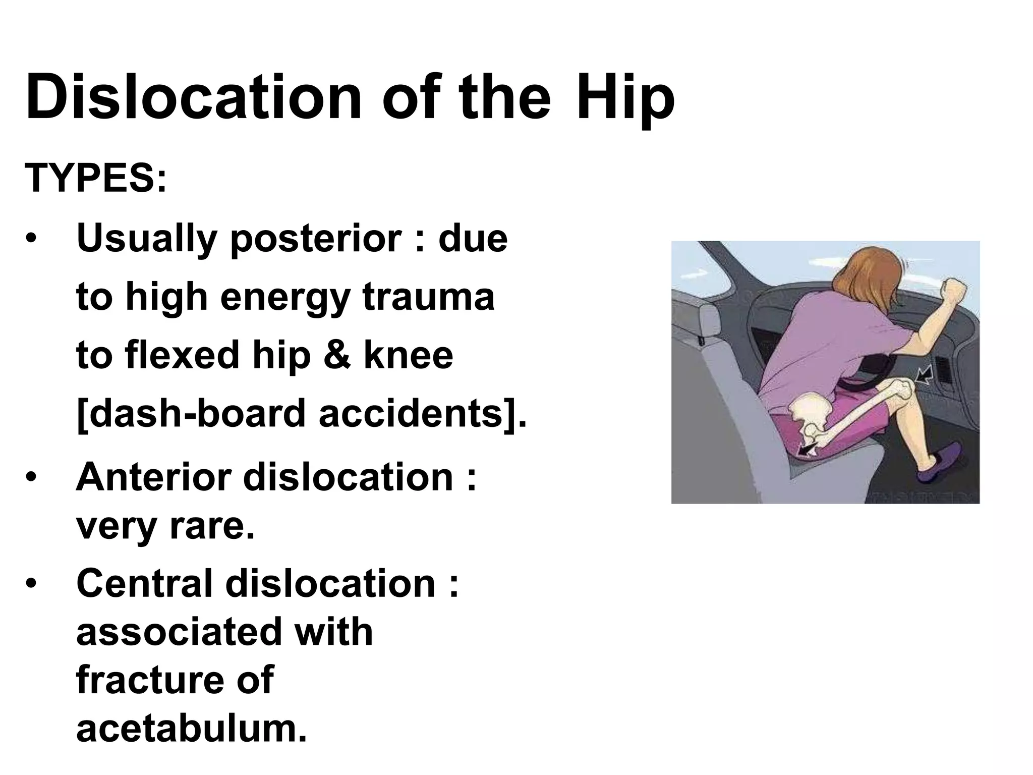 Joint Dislocation | PPTX