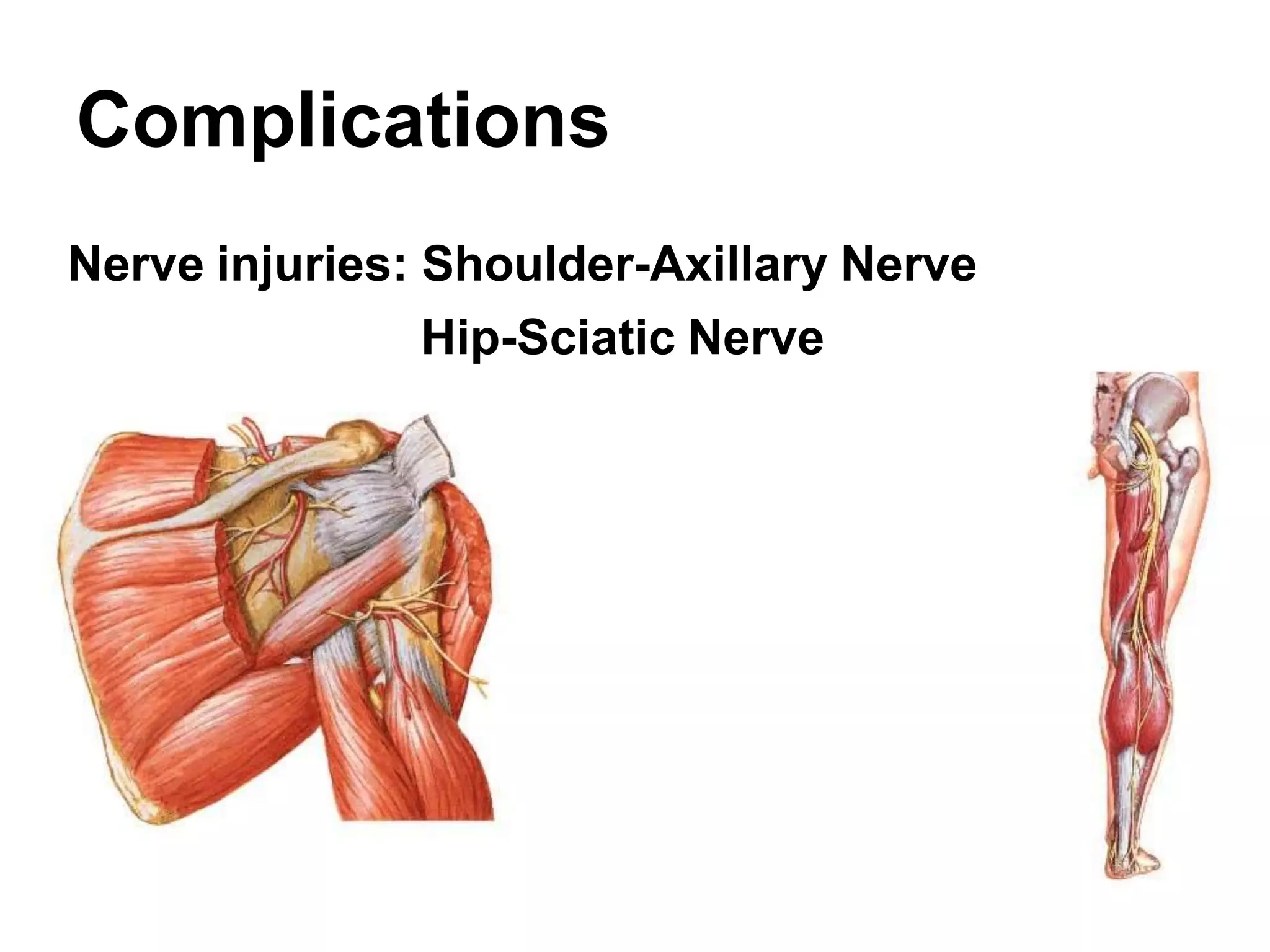 Joint Dislocation | PPTX