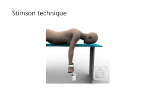 dislocation.pptx