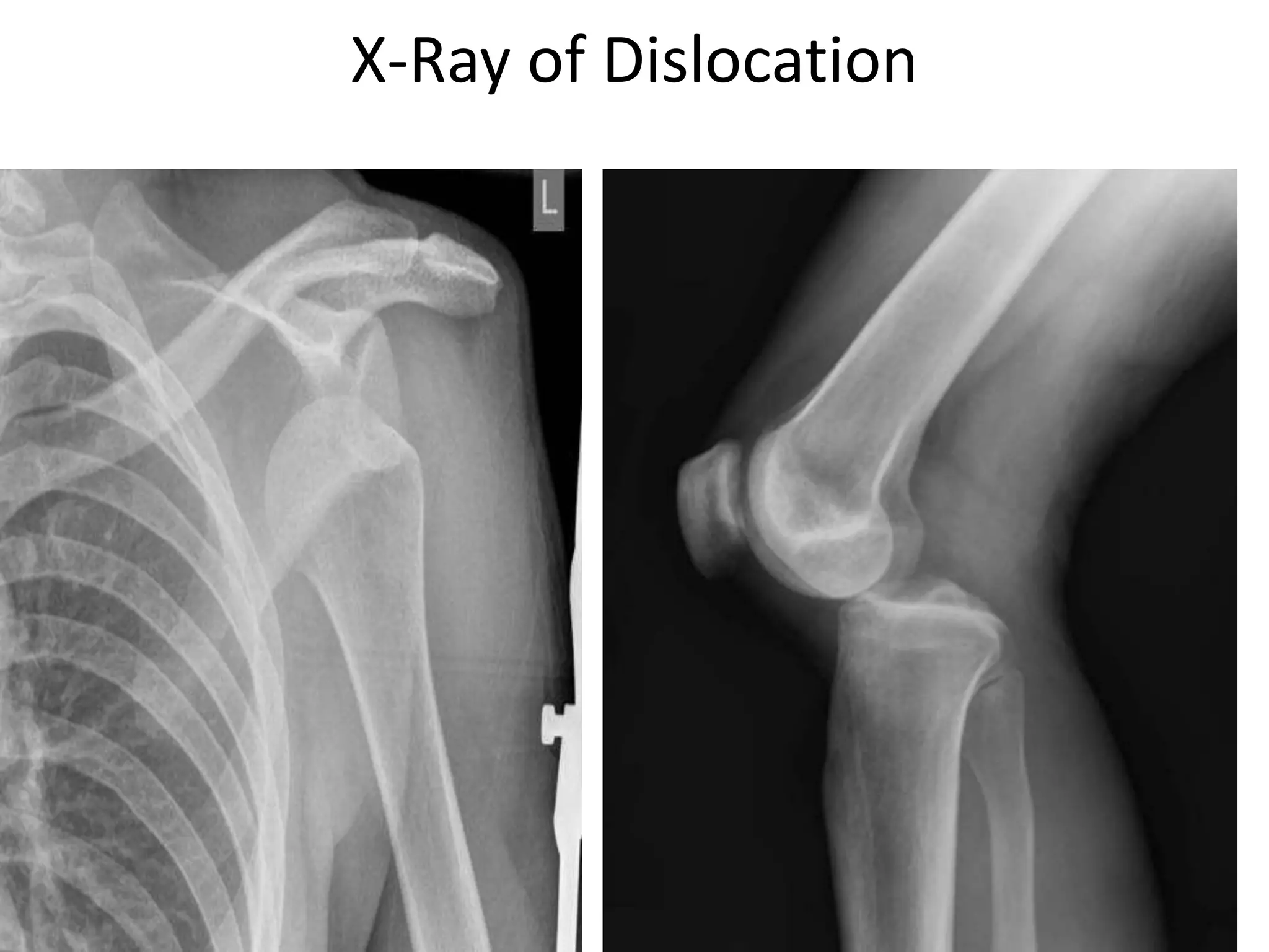 Dislocation.pptx