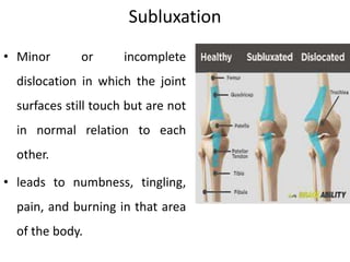 Dislocation.pptx | Death, Injury, or Military Conflict | Sensitive Topics