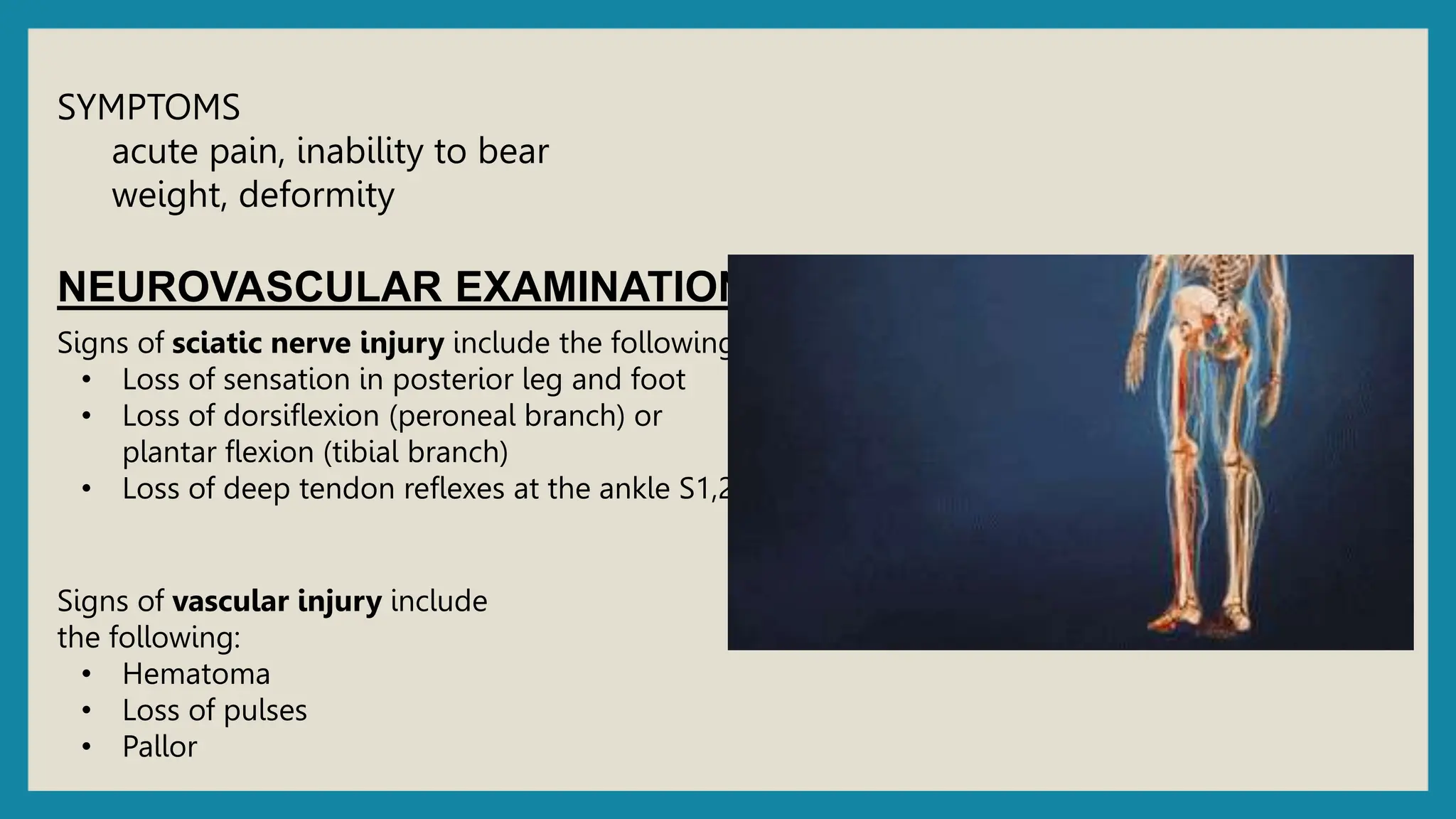 hip, shoulder and elbow dislocation.pptx