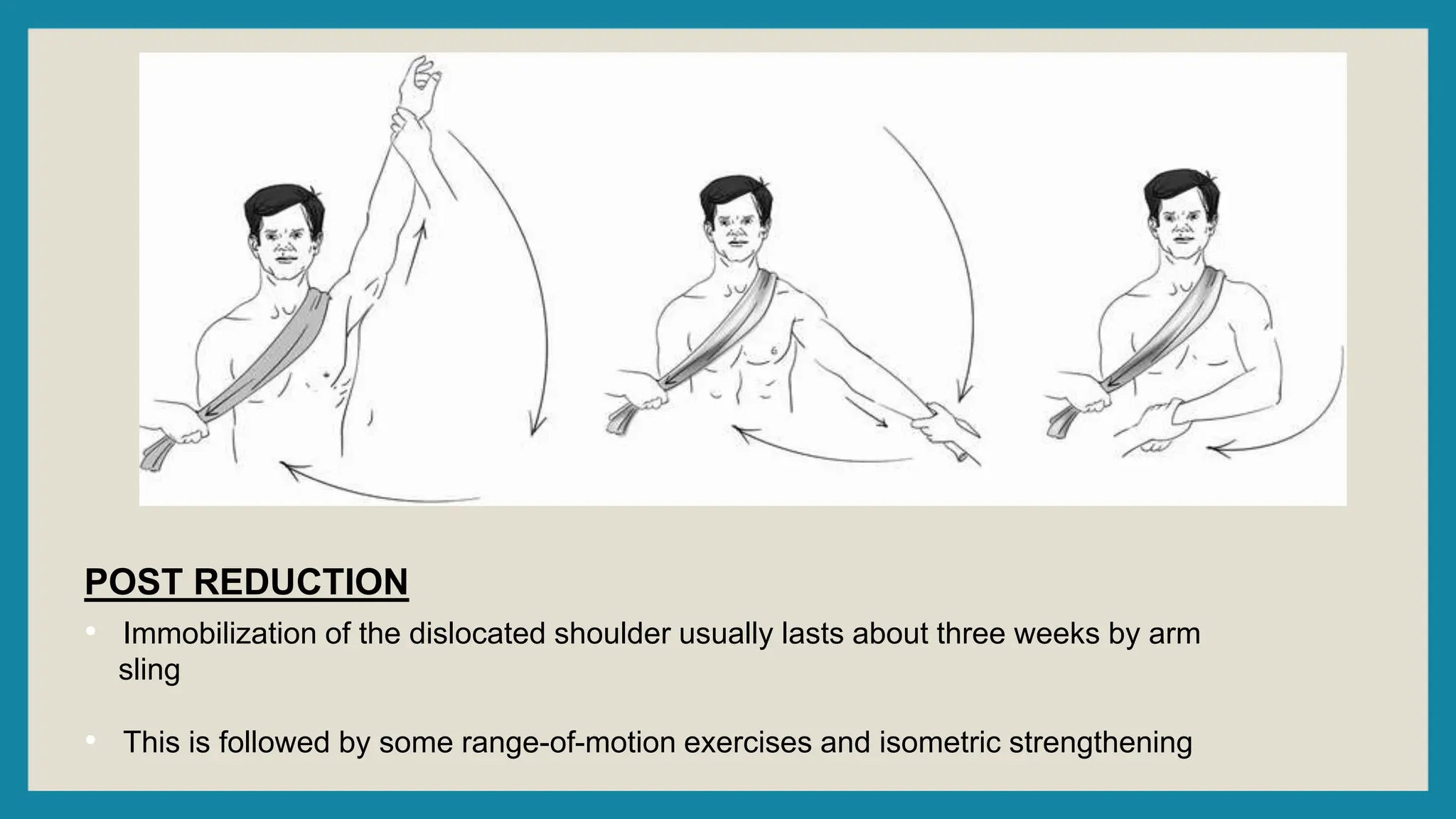 hip, shoulder and elbow dislocation.pptx