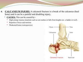 DISLOCATION AND BONE INJURIES (extremities) | PPTX