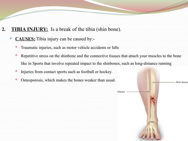 DISLOCATION AND BONE INJURIES (extremities) | PPT