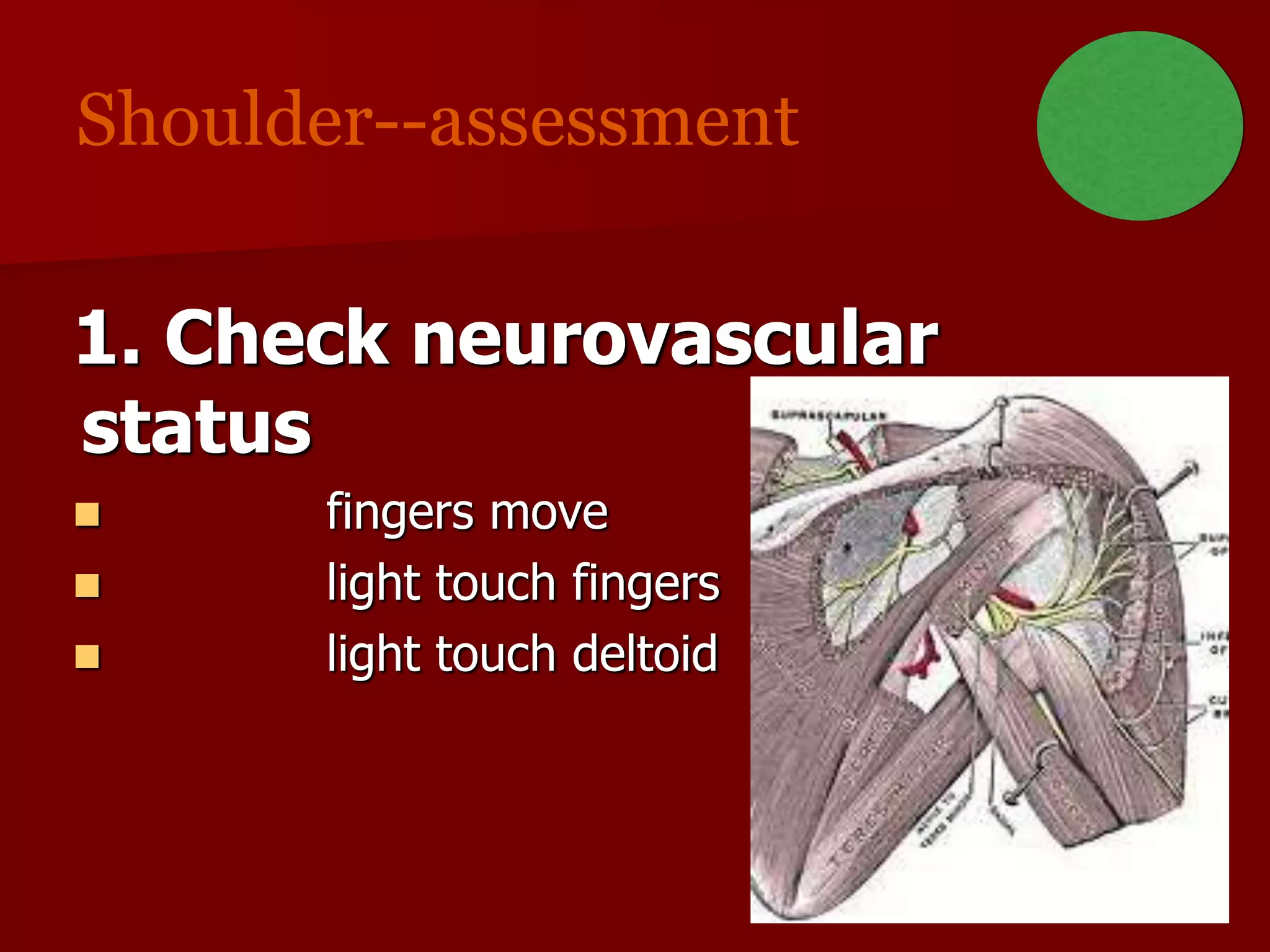 dislocation and subluxation 3.ppt