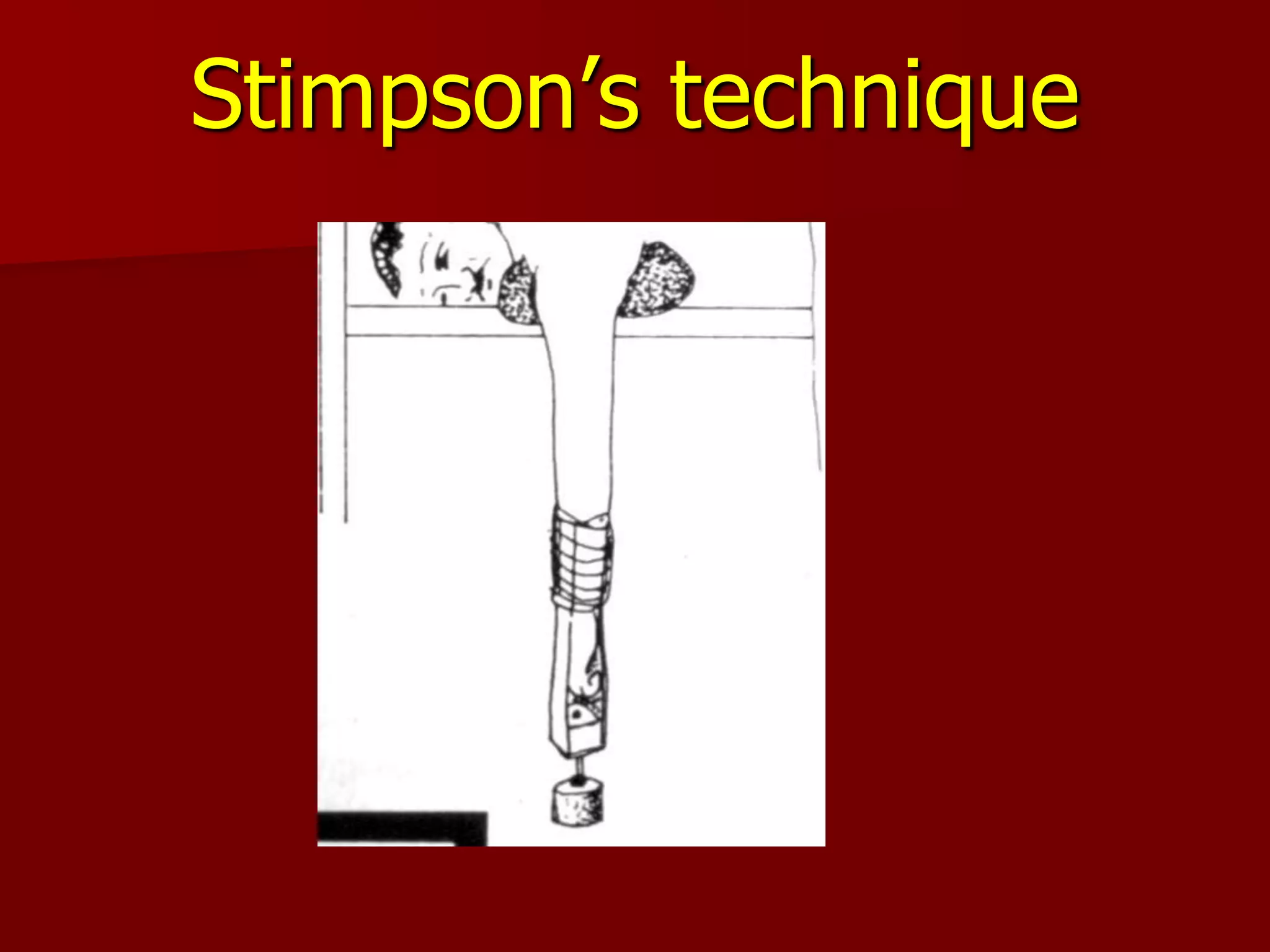 dislocation and subluxation 3.ppt