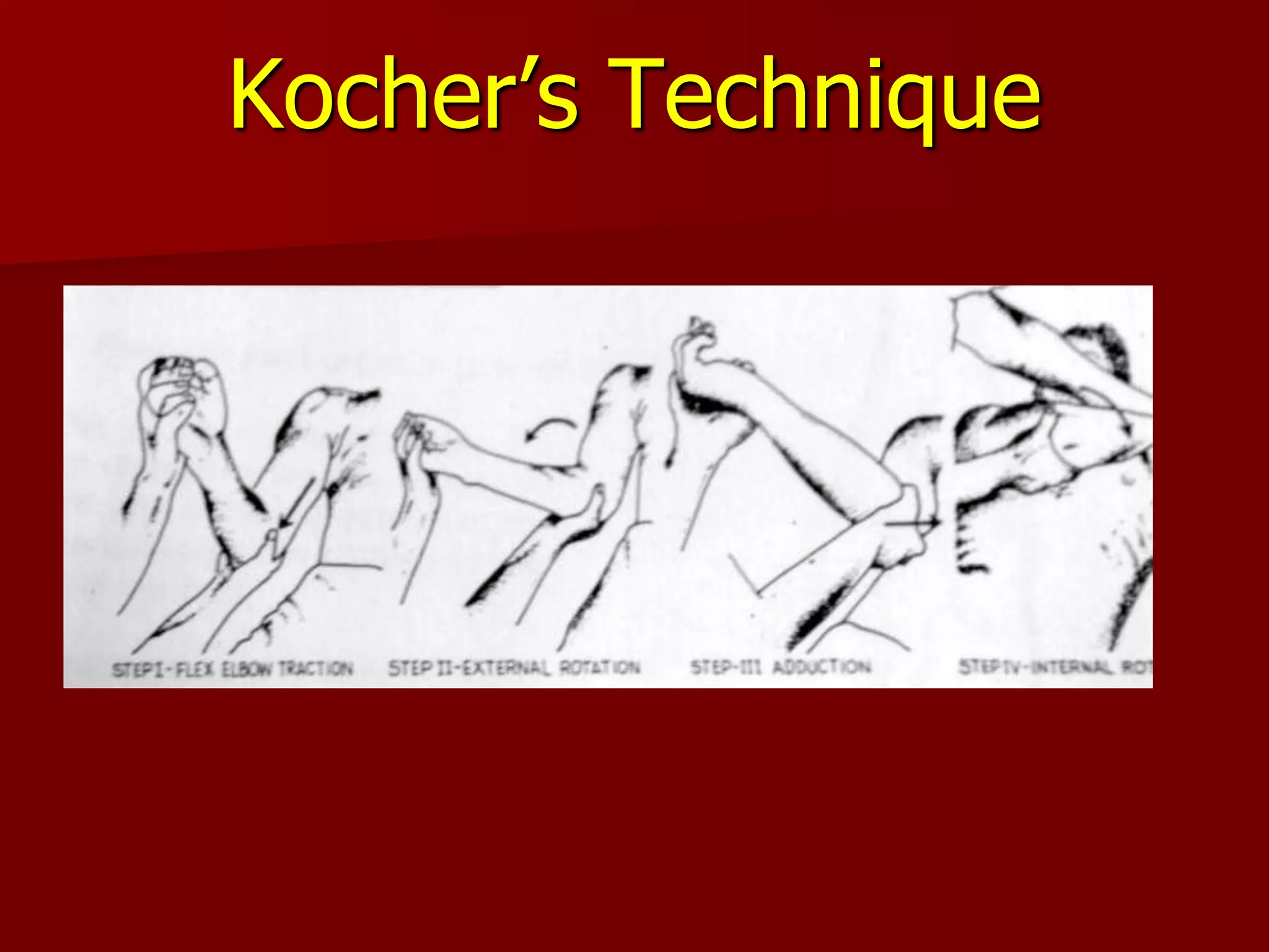 dislocation and subluxation 3.ppt