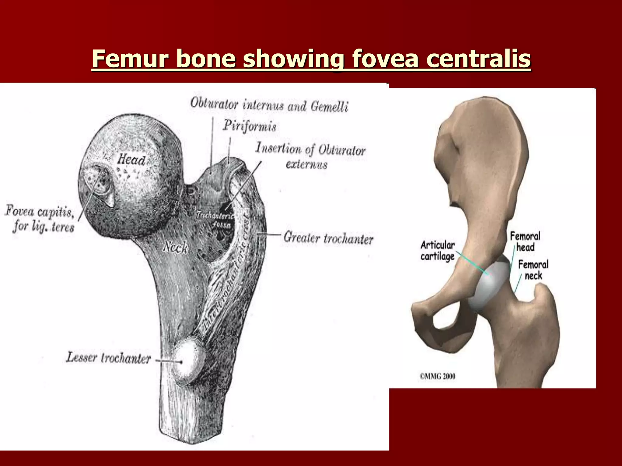 dislocation and subluxation 3.ppt