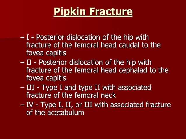 dislocation and subluxation 3.ppt