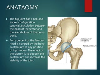 Dislocation of hip | PPTX