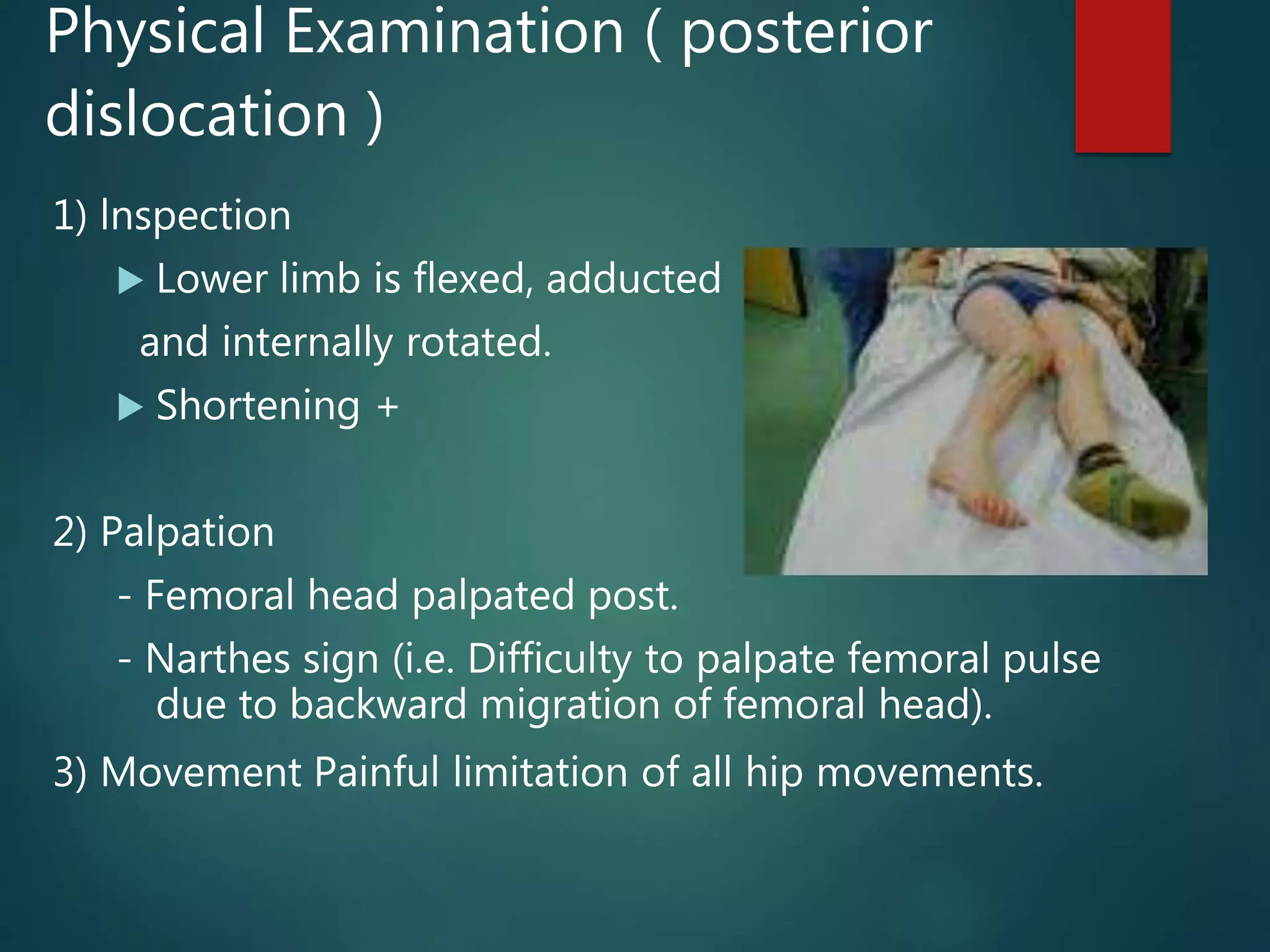 Dislocation of hip | PPTX