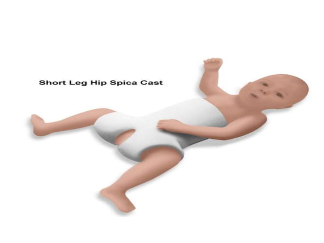 Dislocation of hip | PPTX | Pregnancy | Reproductive Health