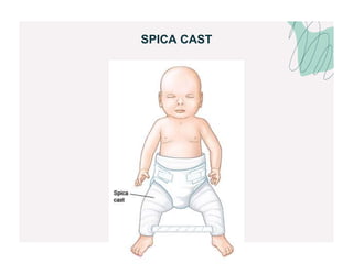 Congenital Dislocation of hip | PPTX