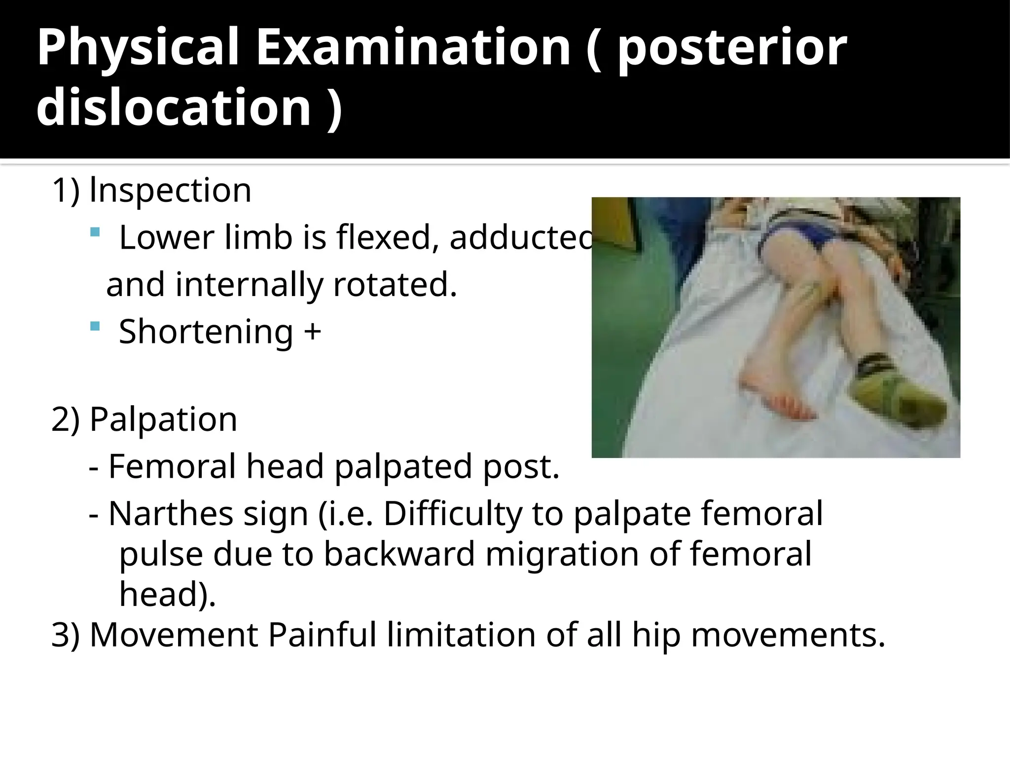 dislocation of hip in adultss class.pptx | Death, Injury, or Military Conflict | Sensitive Topics