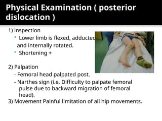 dislocation of hip in adultss class.pptx | Death, Injury, or Military Conflict | Sensitive Topics
