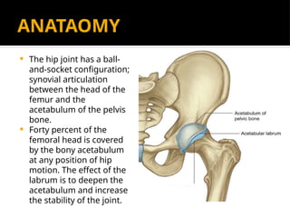 dislocation of hip in adultss class.pptx