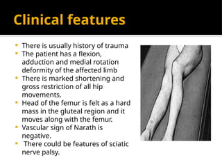 dislocation of hip in adultss class.pptx | Death, Injury, or Military ...