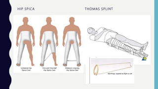 Dislocation of hip joint | PPTX