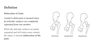 MBBS ORTHOPAEDICS Dislocation of Joints.pptx