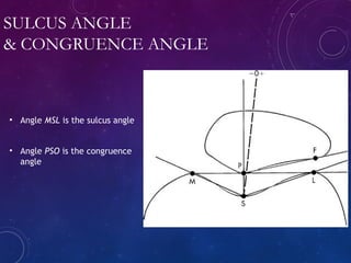 Recurrent Dislocation of patella -PAWAN | PPT