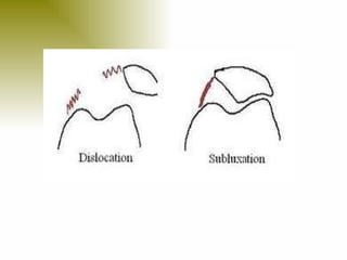 Dislocation of patella | PPT