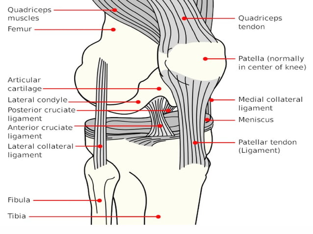 Dislocation of patella | PPT | Death, Injury, or Military Conflict ...