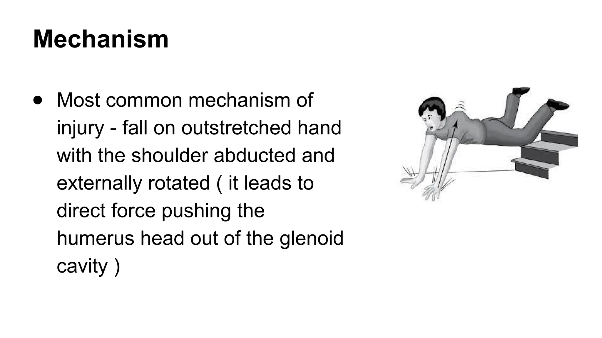 Dislocation of the shoulder mechanism and pathoanatomy | PPTX