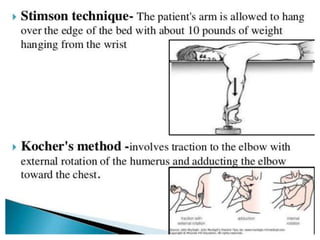 Dislocations And Fractures Of Bones pptx | PPTX