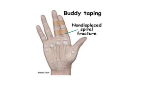 Dislocations of the bone by dr amna hussain | PPTX