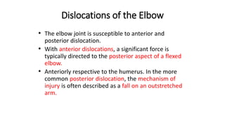 Dislocations of the bone by dr amna hussain | PPTX
