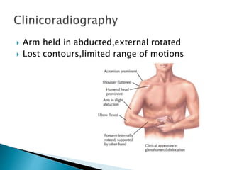 DISLOCATIONS,Emegency Care.pptx