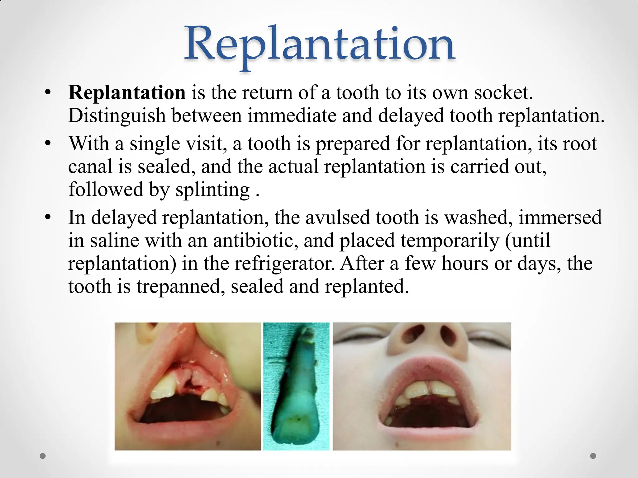 dislocations and fractures of the teeth.pdf