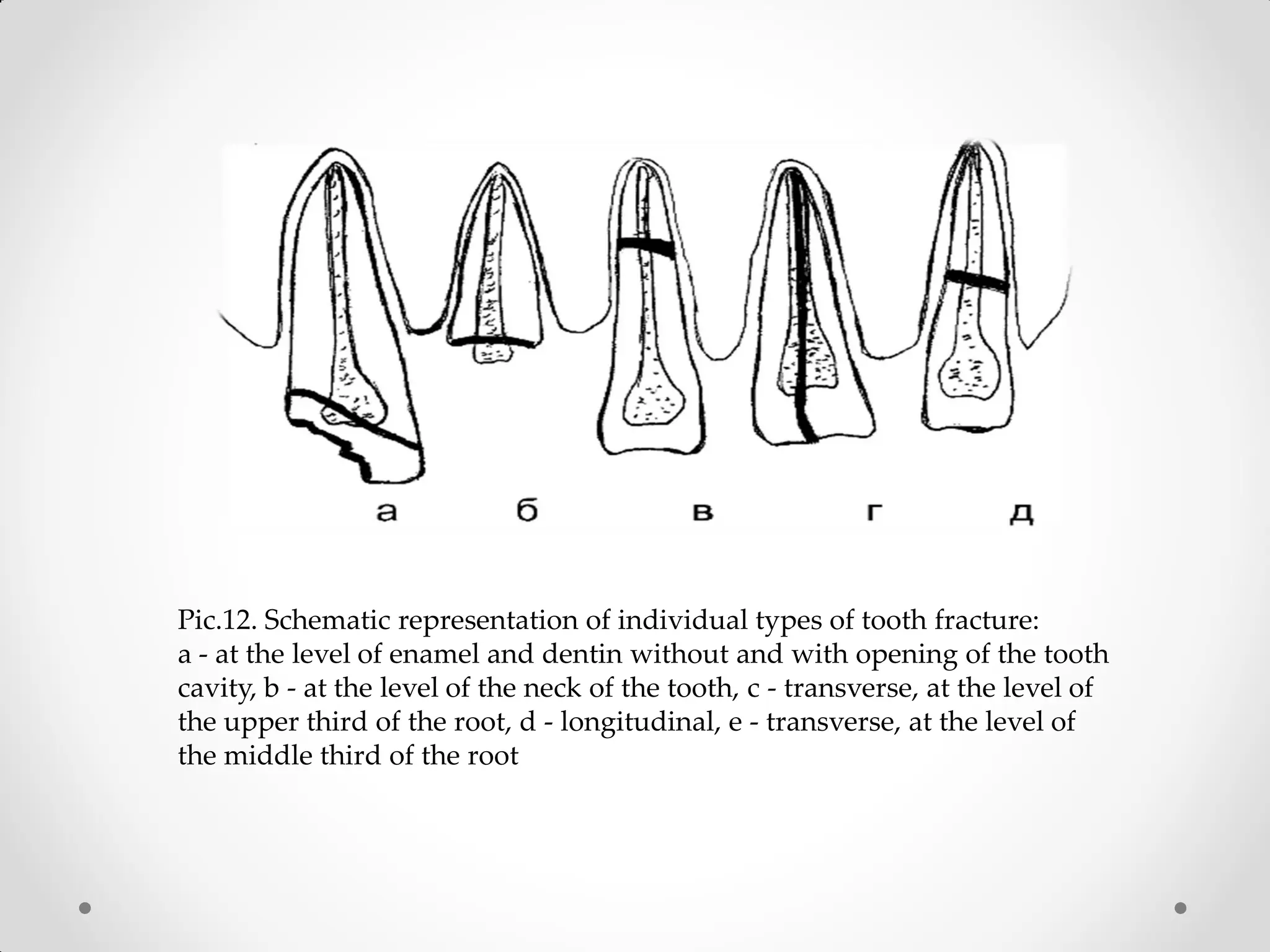 dislocations and fractures of the teeth.pdf