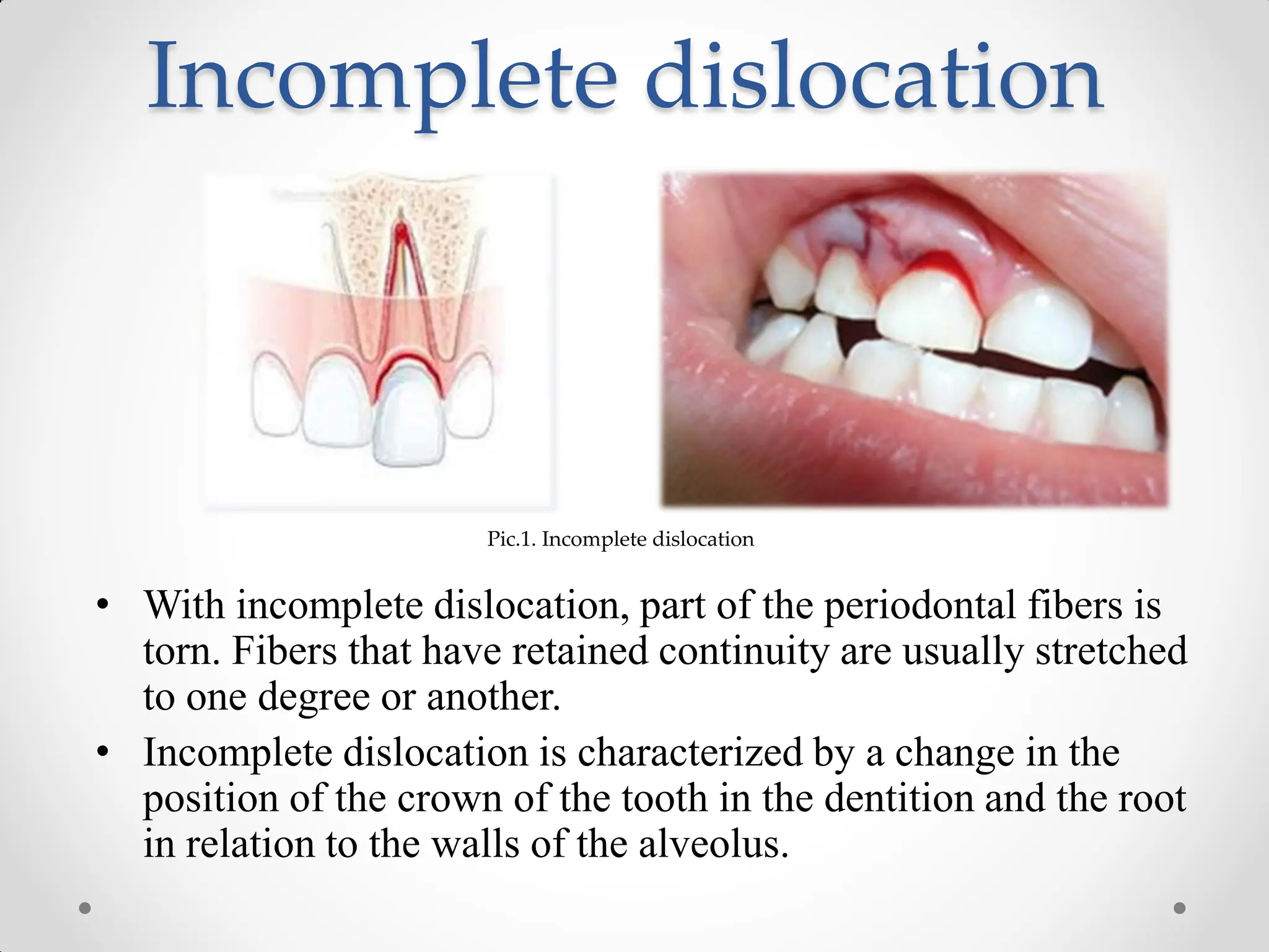 dislocations and fractures of the teeth.pdf