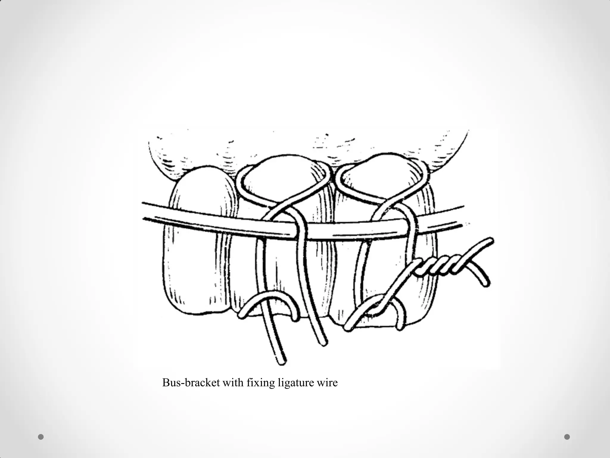 dislocations and fractures of the teeth.pdf