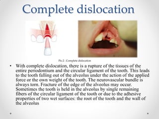 dislocations and fractures of the teeth.pdf