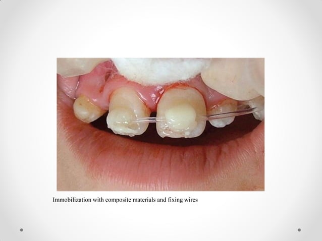 dislocations and fractures of the teeth.pdf