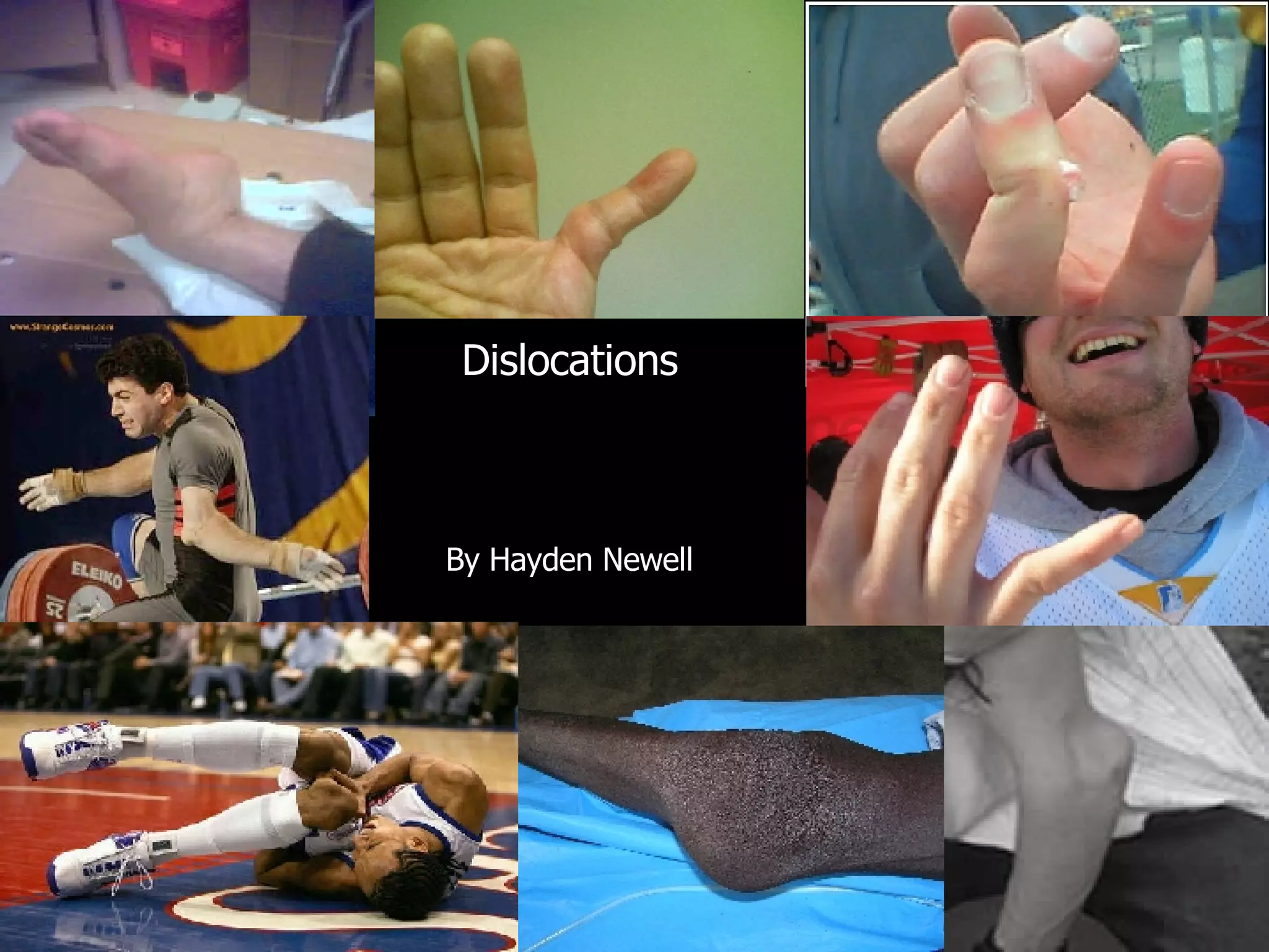 Dislocations | PPT