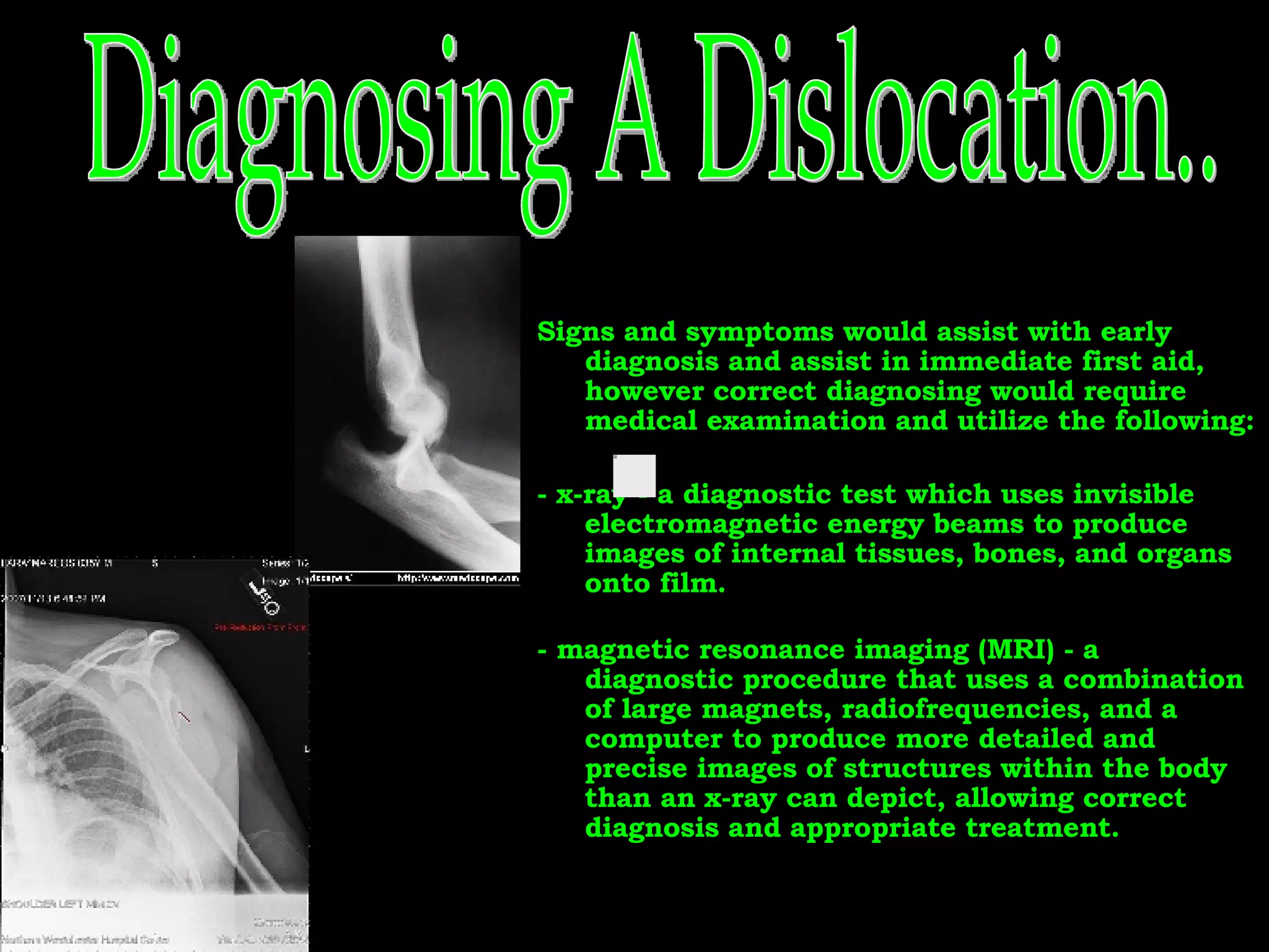 Dislocations | PPT